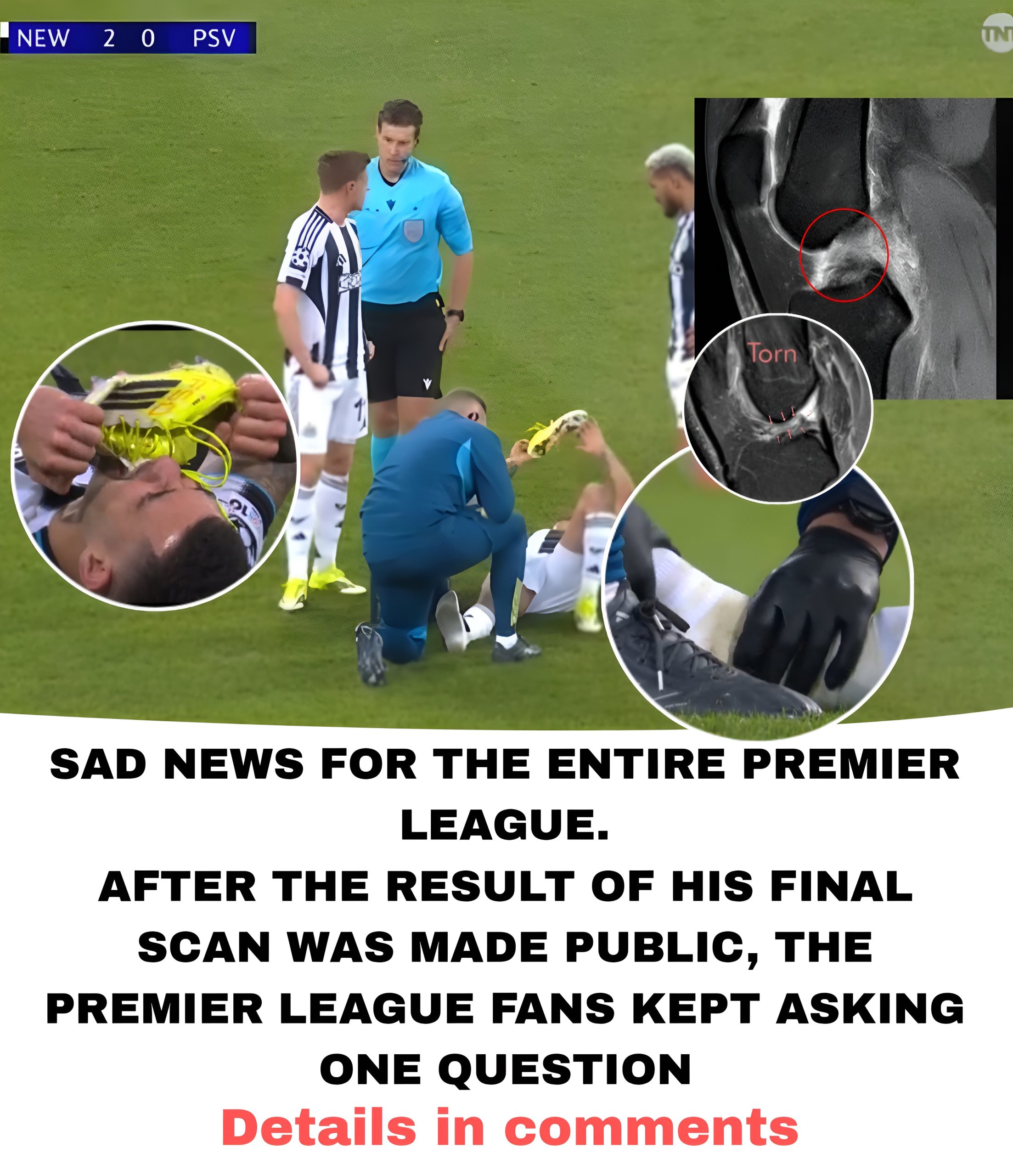 HUGE UPDATE ON BRUNO GUIMARAES INJURY 洛 “The medical team has just ...